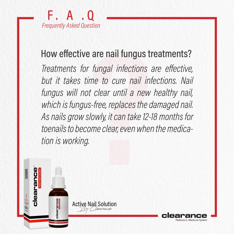 Clearance Active Nail Solution 30ml